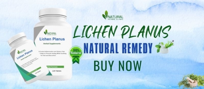 USE HERBAL REMEDIES TO STOP LICHEN PLANUS SYMPTOMS FROM SPREADING ...